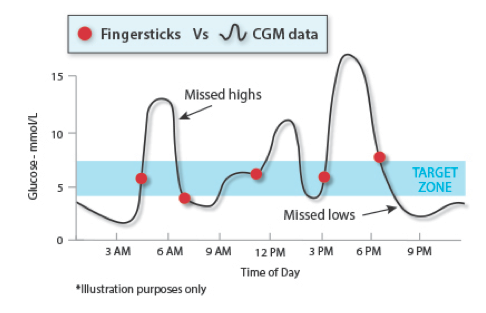 Diabetes phone apps and CGMs - do they result in improved patient ...